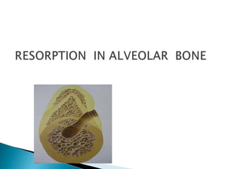 PROSTHODONTIC MANAGEMENT OF RESIDUAL RIDGE REDUCTION | PPT