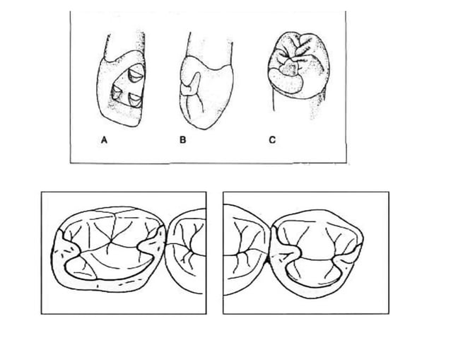 Resin bonded FPDs | PPT | Dental Health | Diseases and Conditions