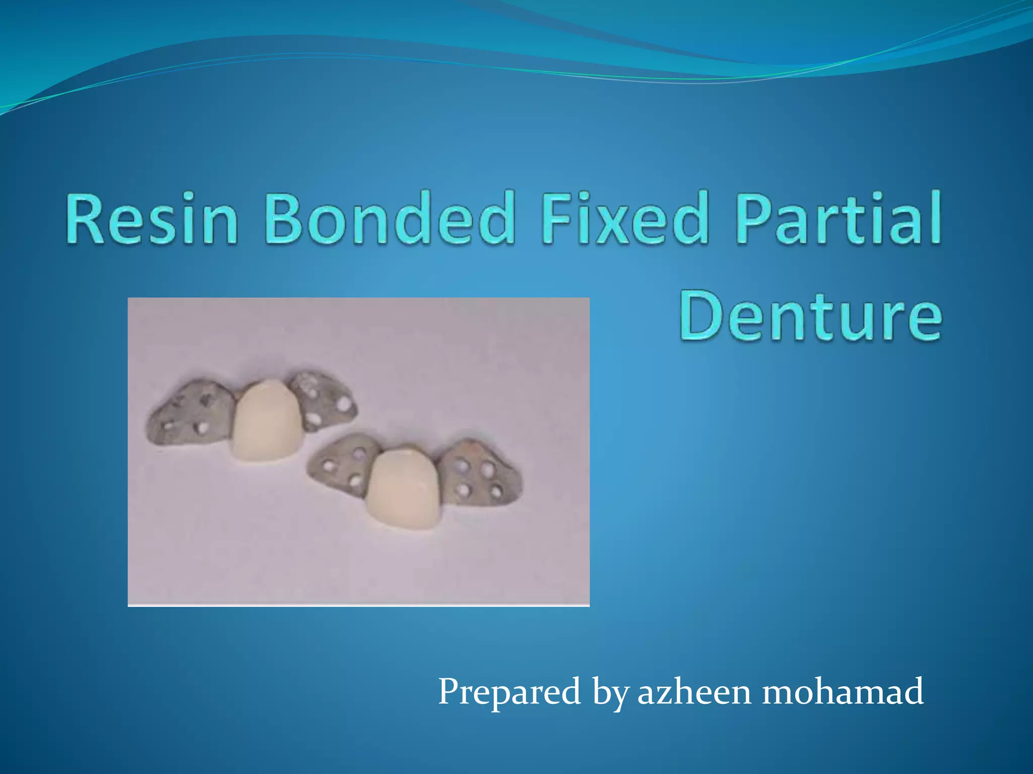 Resin bonded fixed partial denture | PPTX