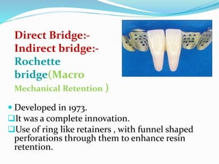 Resin bonded fixed partial denture | PPTX