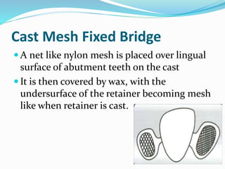 Resin bonded fixed partial denture | PPTX