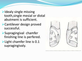 Resin bonded fixed partial denture | PPTX