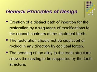 Resin Bonded Bridges mary land bridge.ppt