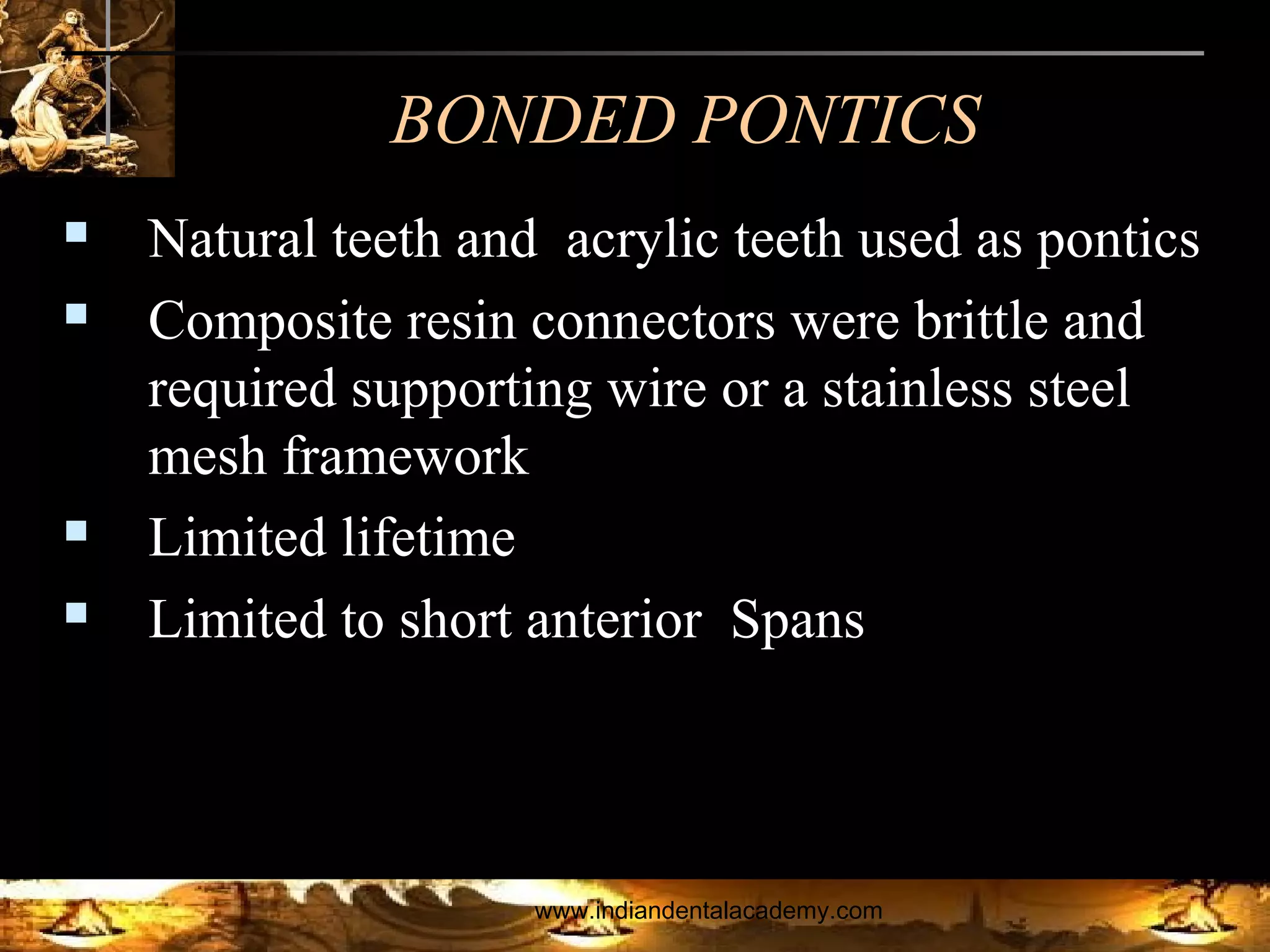 Resin bonded fpd/ academy general dentistry | PPT