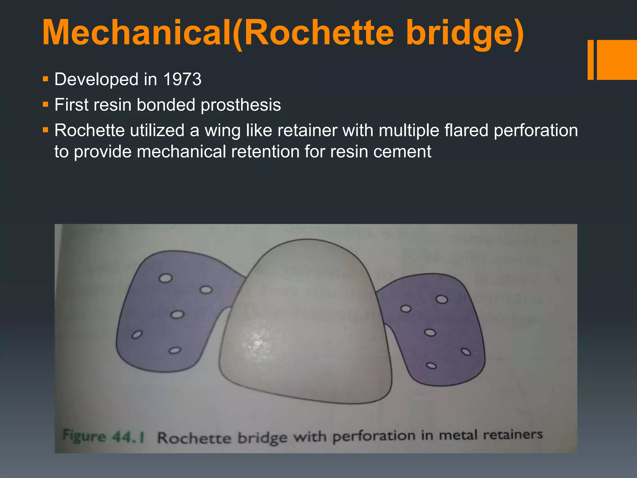 RESIN BONDED FPD.pptx