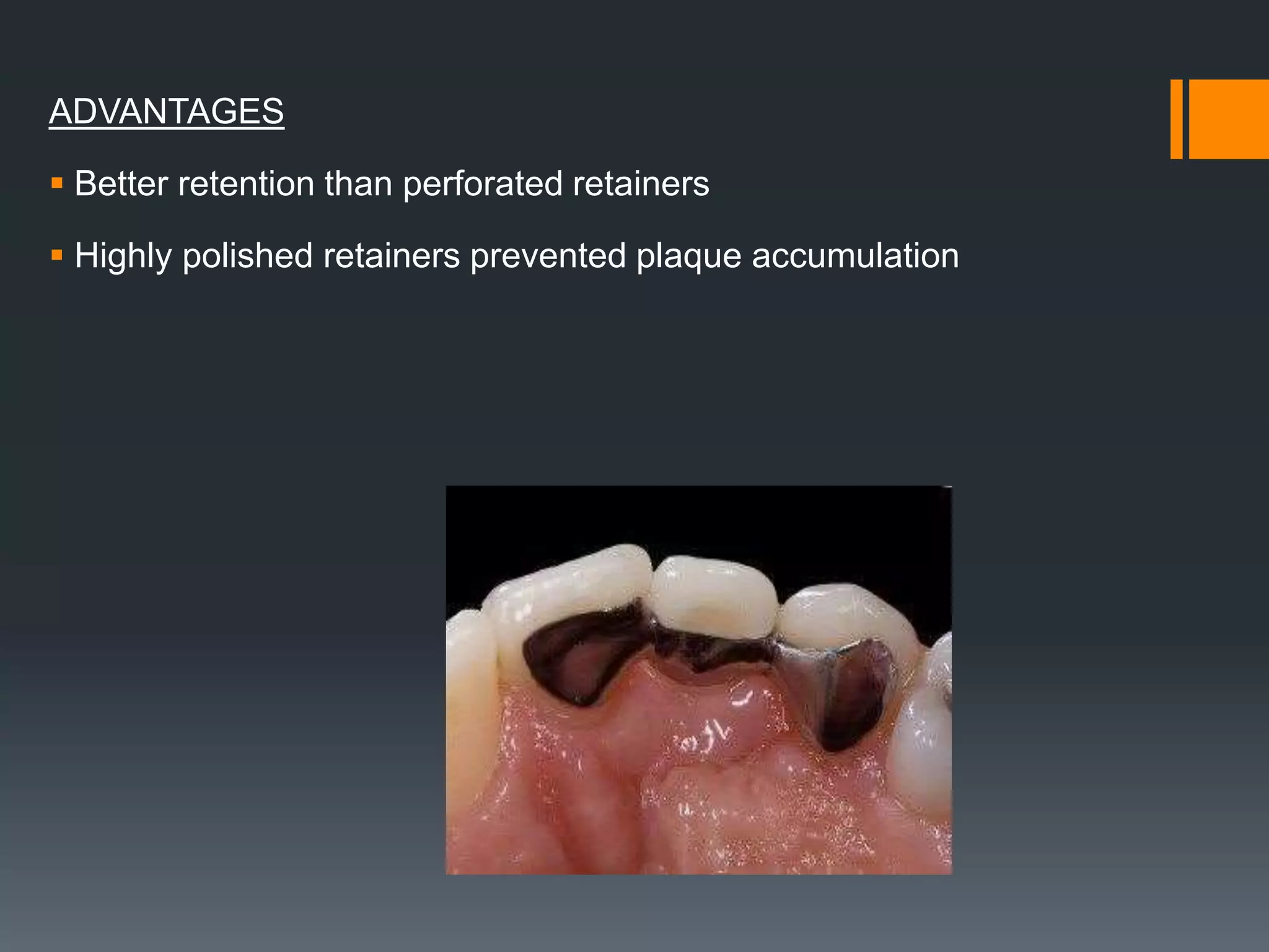 RESIN BONDED FPD.pptx