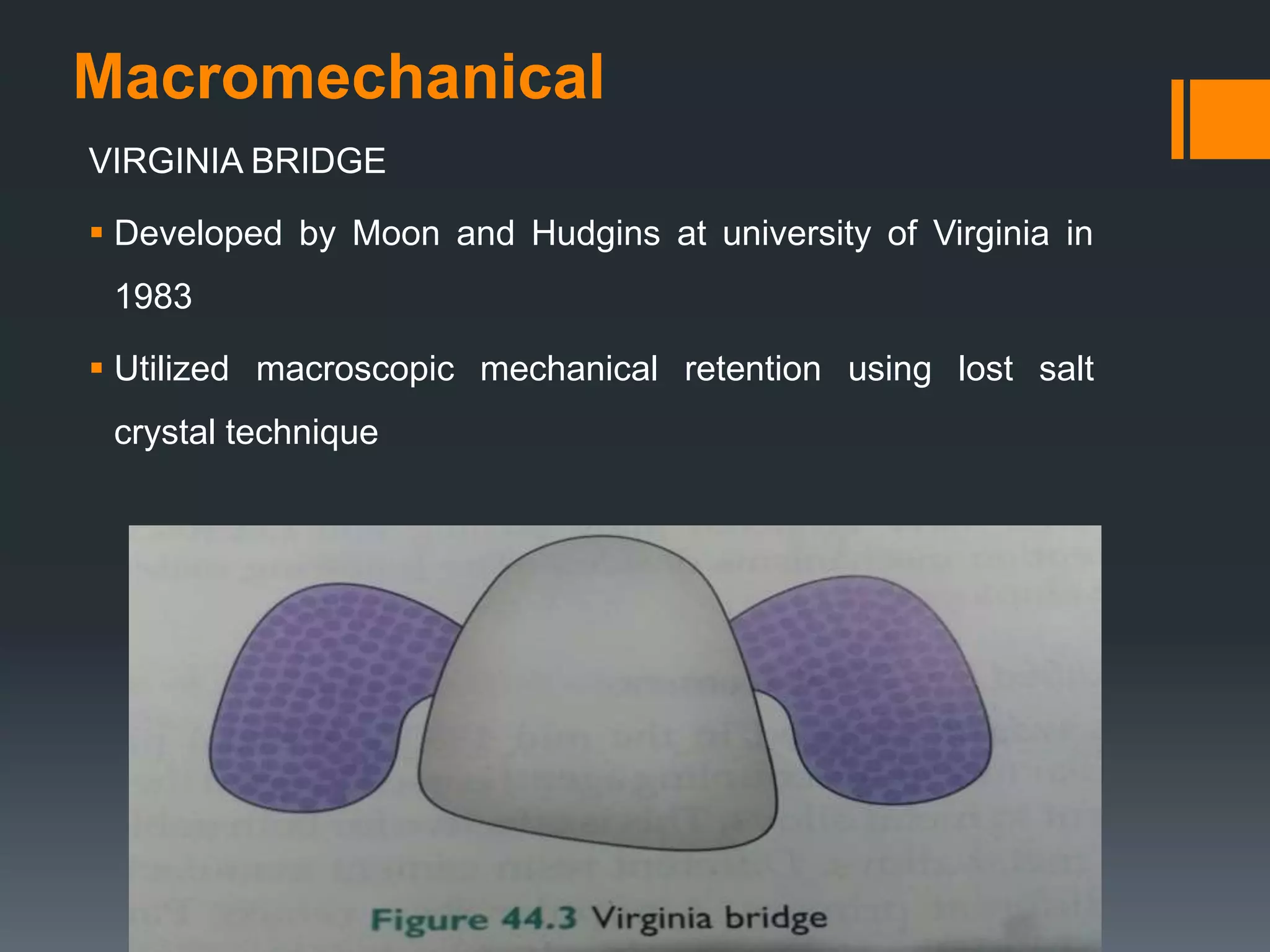 RESIN BONDED FPD.pptx