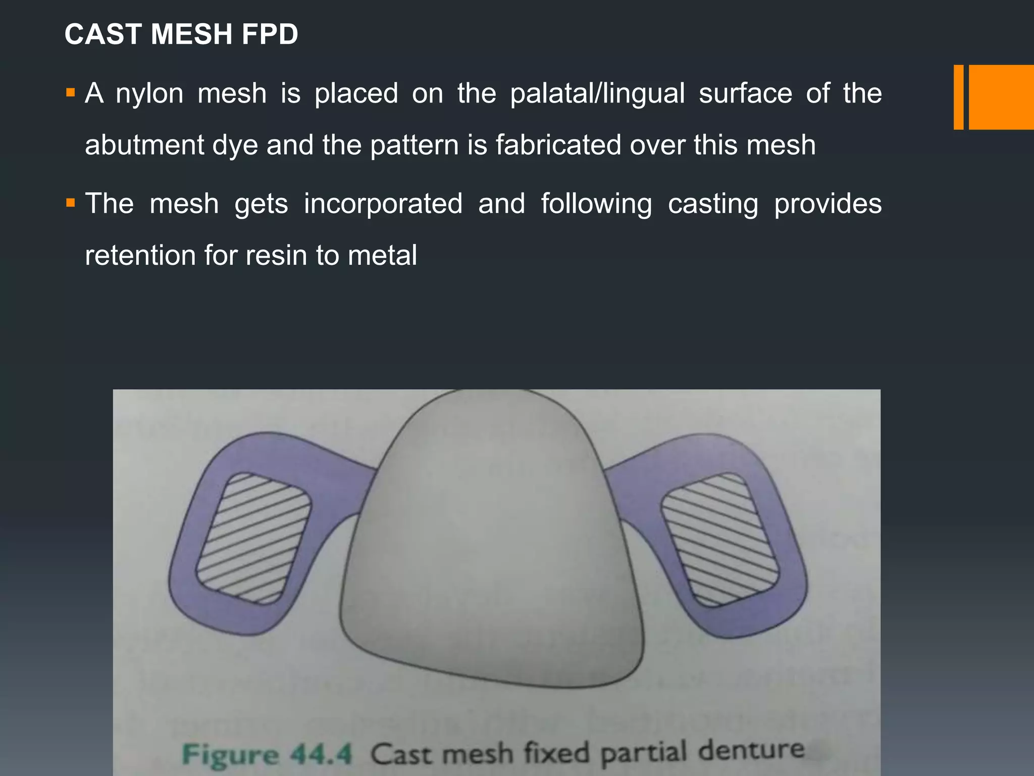 RESIN BONDED FPD.pptx