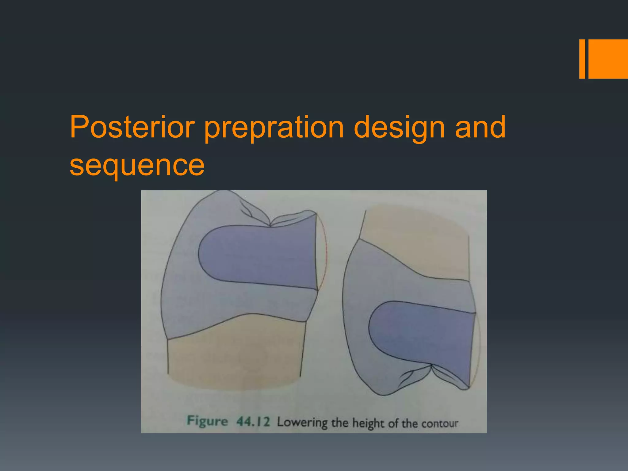 RESIN BONDED FPD.pptx