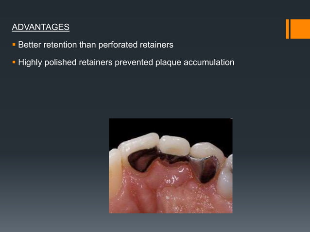 RESIN BONDED FPD.pptx
