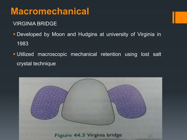 RESIN BONDED FPD.pptx