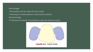 Resin Bonded fpd.pdf
