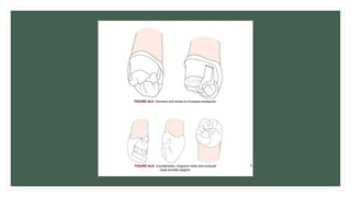 Resin Bonded fpd.pdf