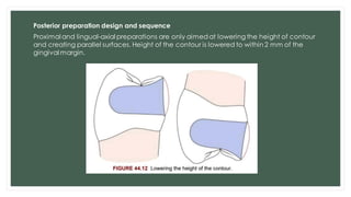 Resin Bonded fpd.pdf