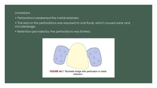 Resin Bonded fpd.pdf