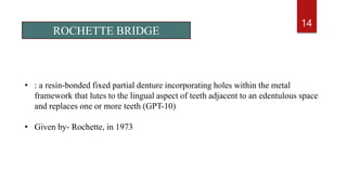 Resin bonded fixed partial denture. (RBFPD'S) | PPTX
