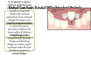 Resin bonded Fixed partial denture - treatment option | PPTX