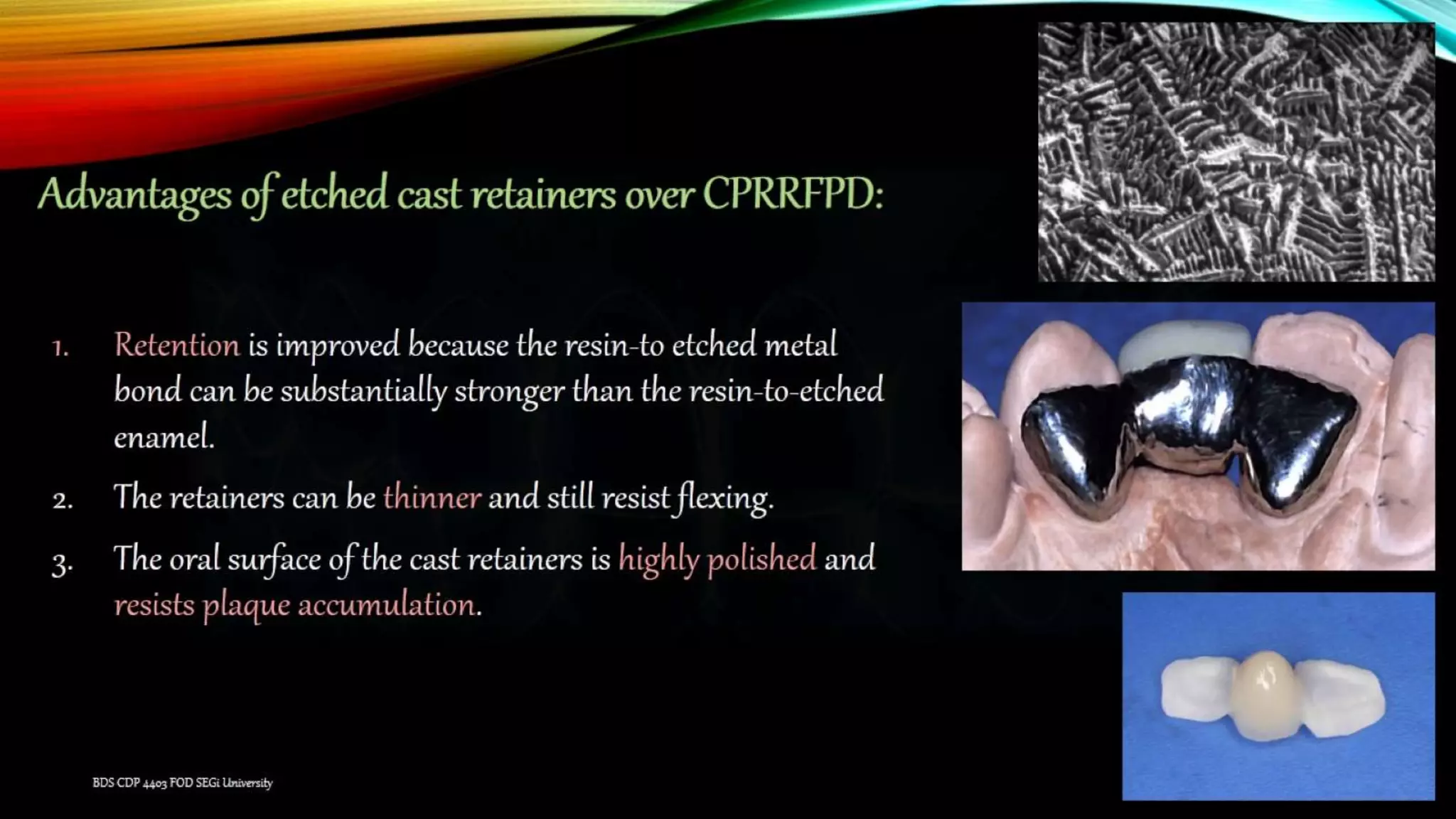 Anterior Resin bonded FPD | PPT