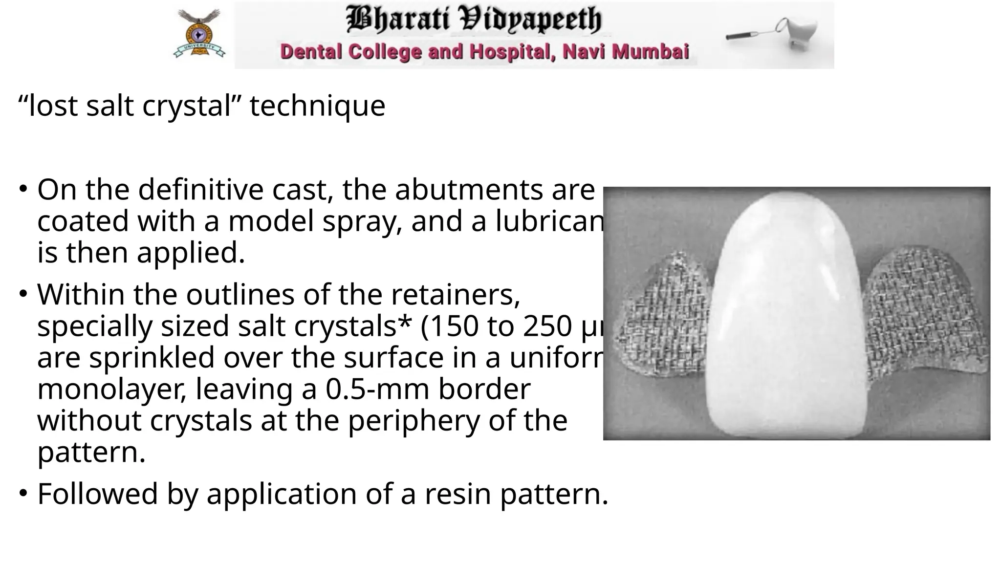 resin bonded prosthesis in fpd .pptx. . | PPTX