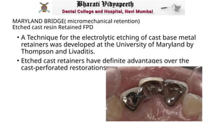 resin bonded prosthesis in fpd .pptx. . | PPTX