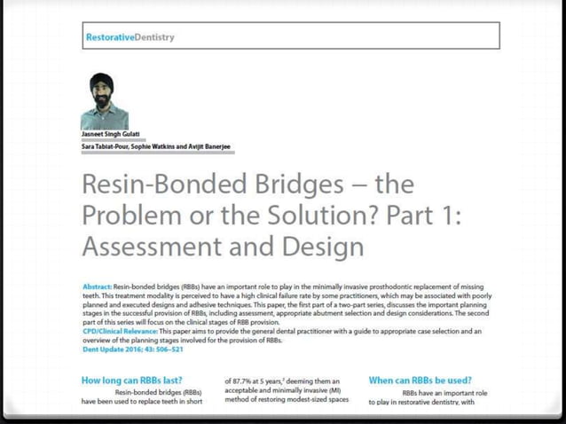 Resin Bonded Bridges | PPTX | Dental Health | Diseases and Conditions