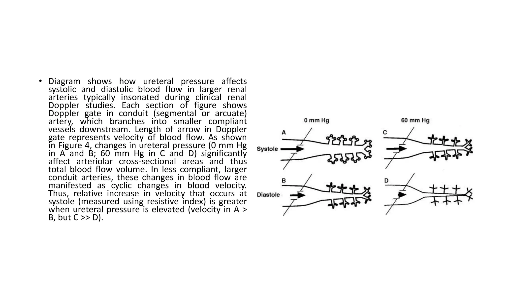 Resistive index and its applications in Urology | PPTX