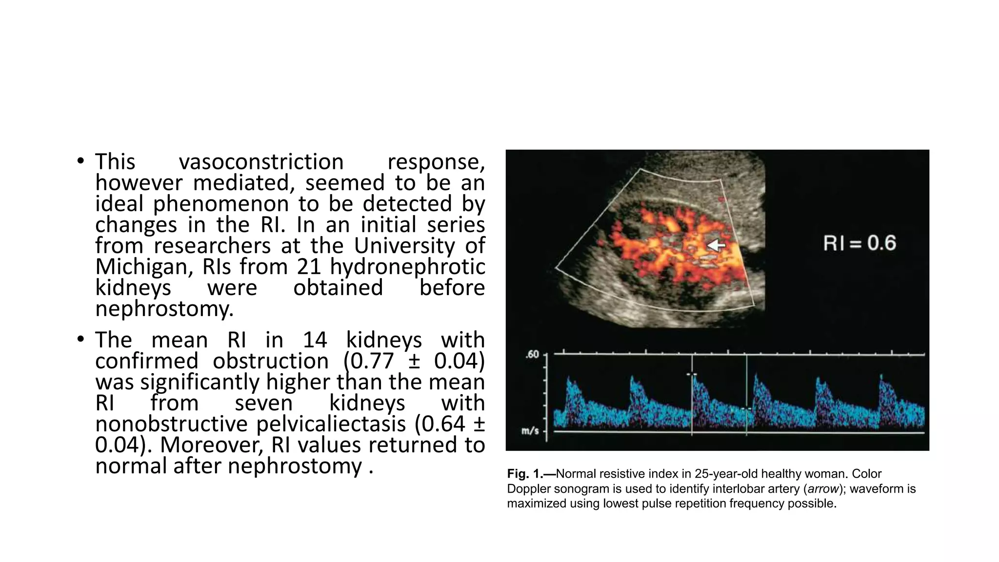 Resistive index and its applications in Urology | PPTX