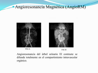 Resonancia magnetica | PPTX
