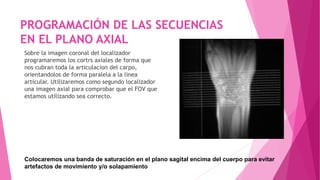 Resonancia magnetica de mano | PPTX