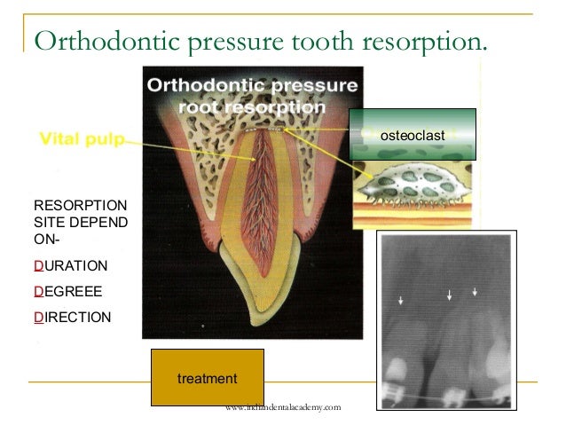 Resorption / dental courses
