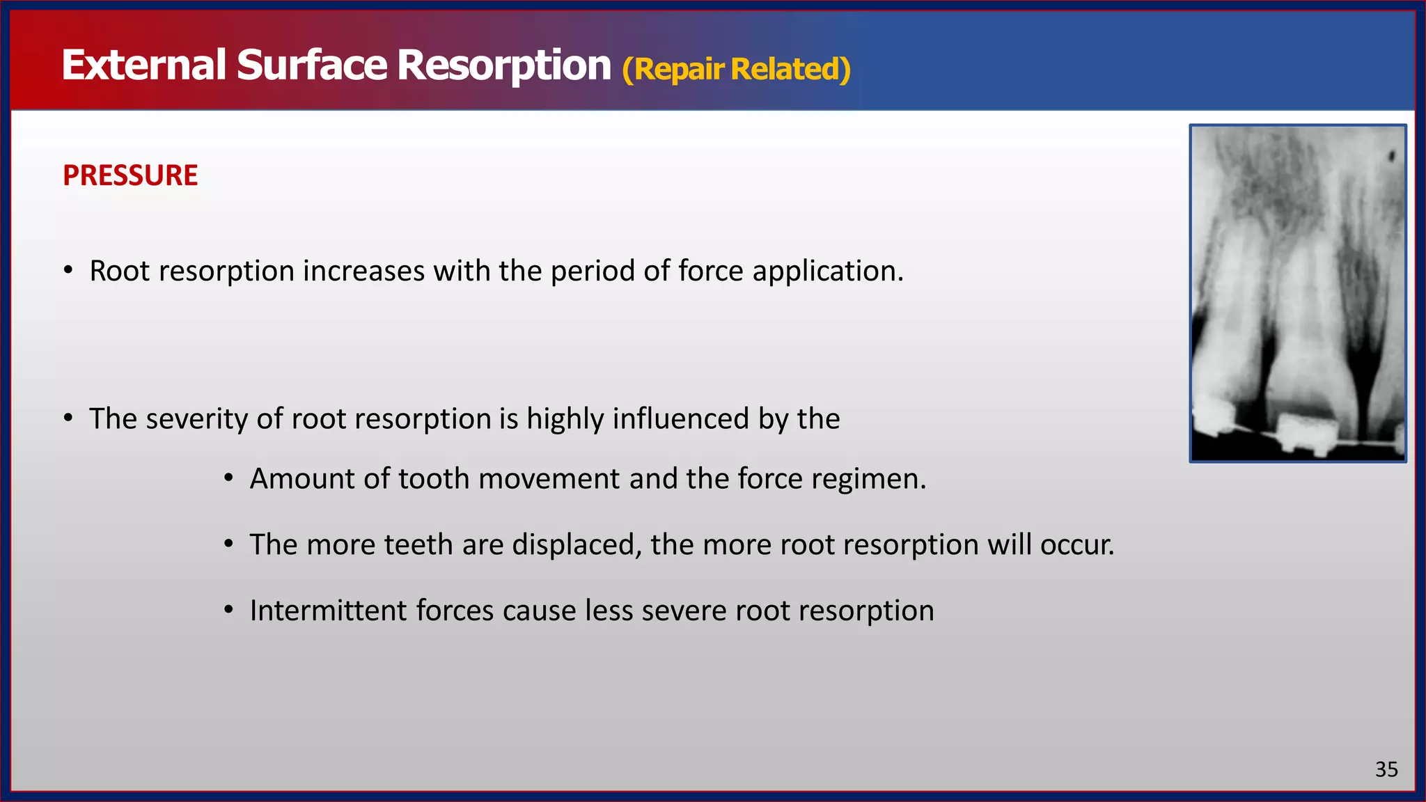 resorption-160714175024.pptx | Bone and Joint Conditions | Diseases and ...