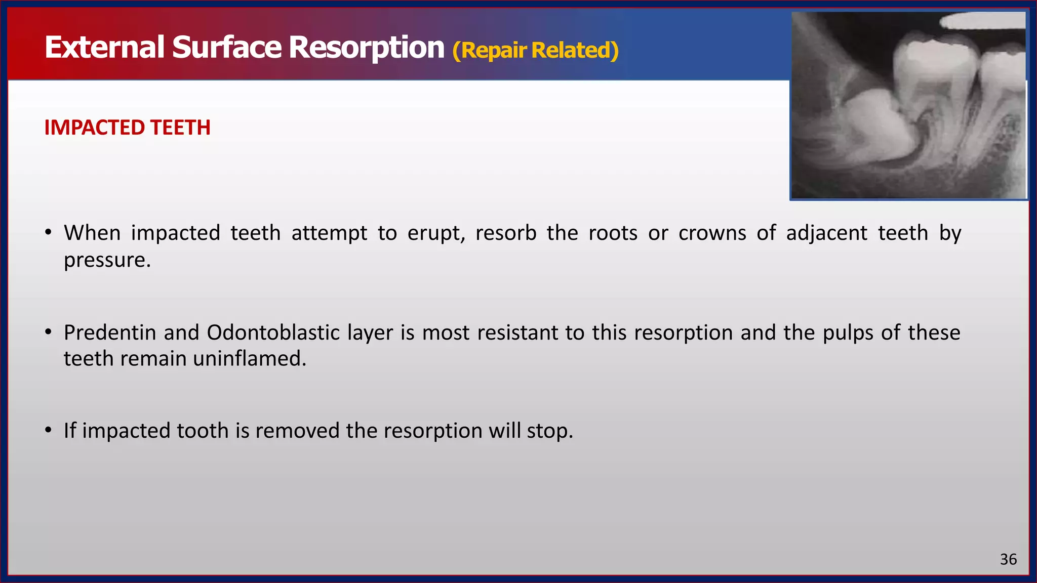 resorption-160714175024.pptx | Bone and Joint Conditions | Diseases and ...