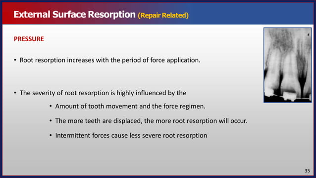 resorption-160714175024.pptx