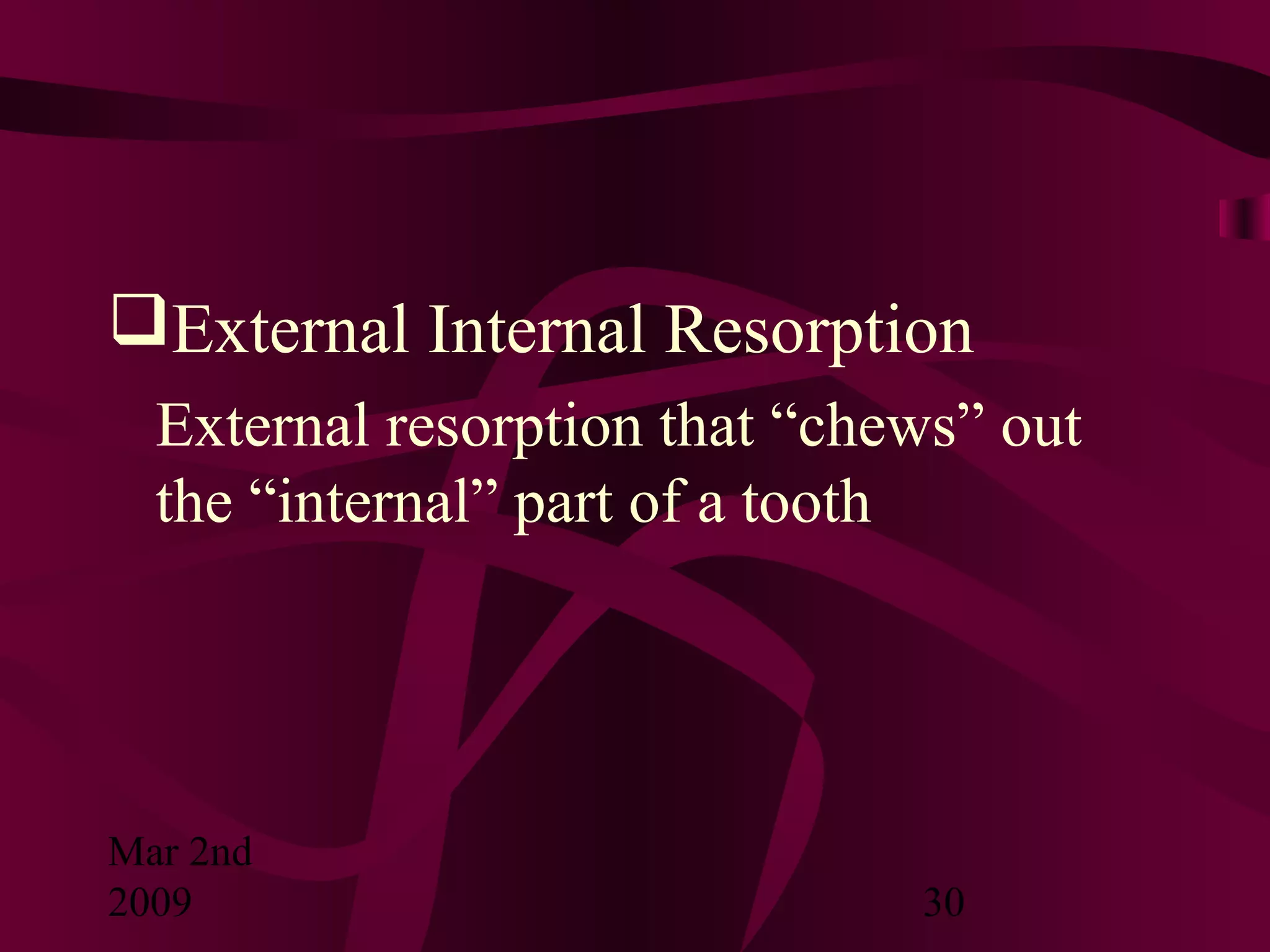 Teeth Resorption | PPT