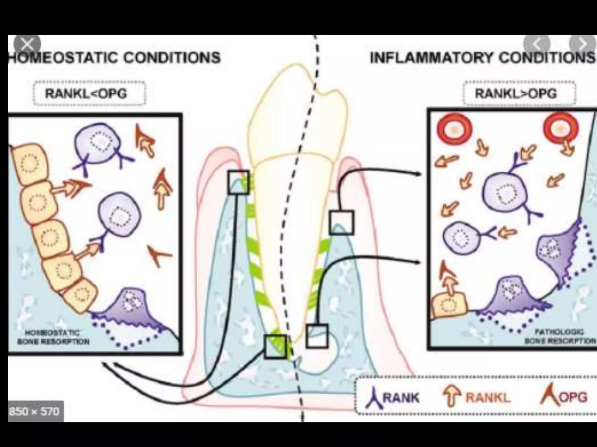 Resorption of teeth | PPTX