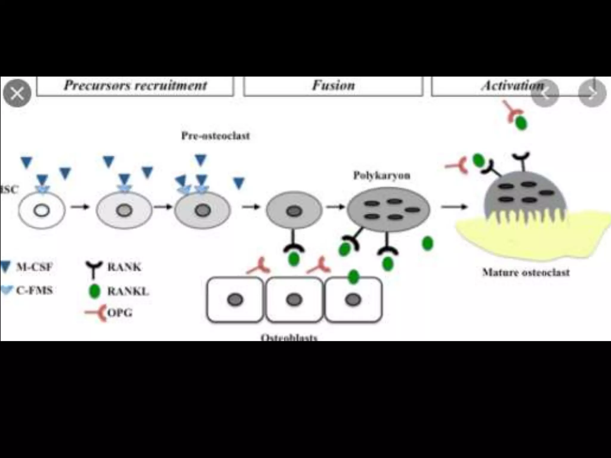 Resorption of teeth | PPTX