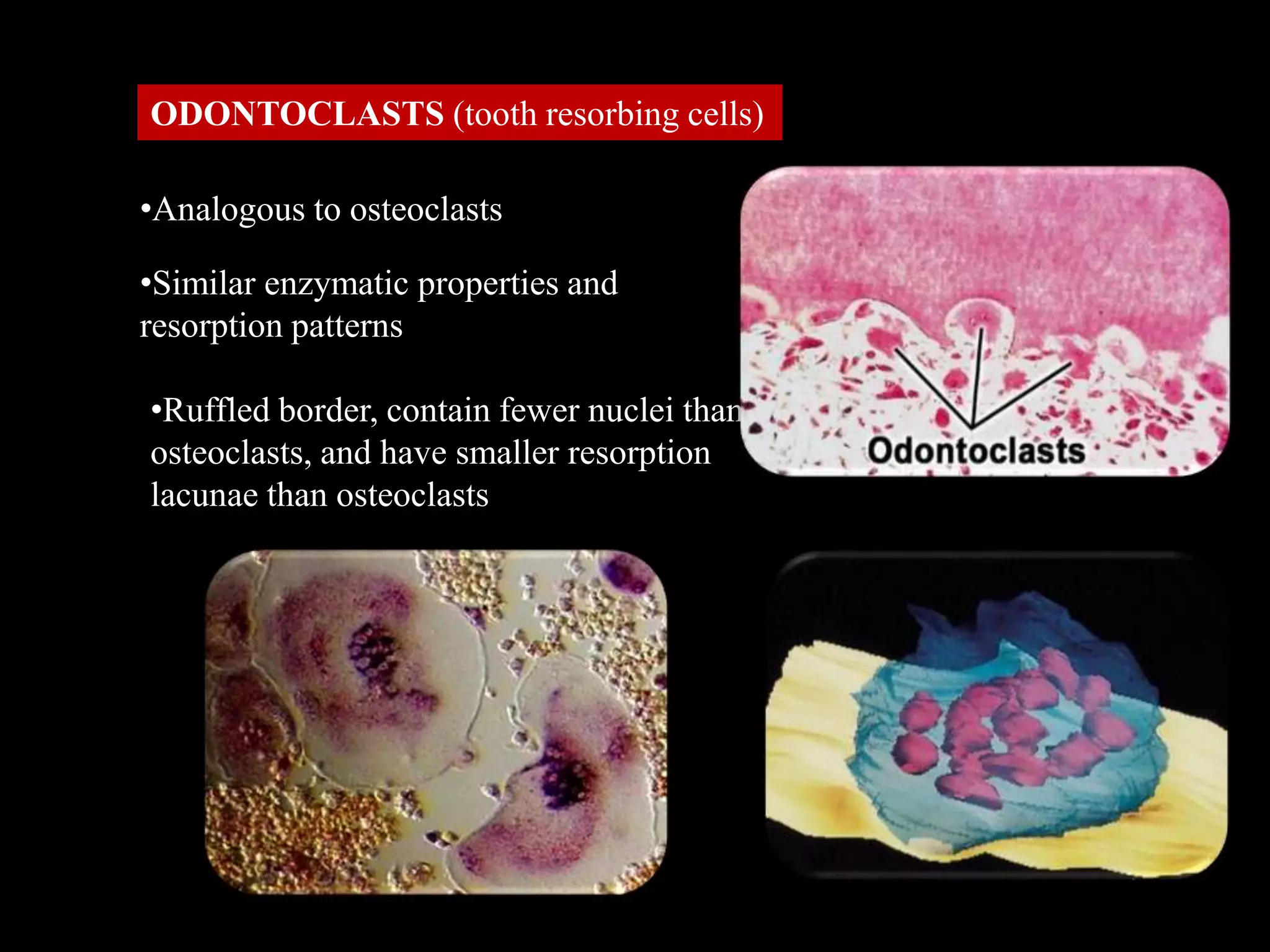 Resorption of teeth | PPTX