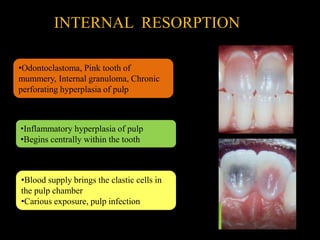 Resorption of teeth | PPTX