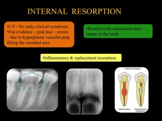 Resorption of teeth | PPTX