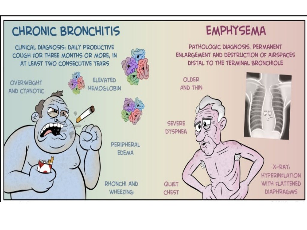 RESPIRATORY SYSTEM: EMPHYSEMA, CHRONIC BRONCHITIS