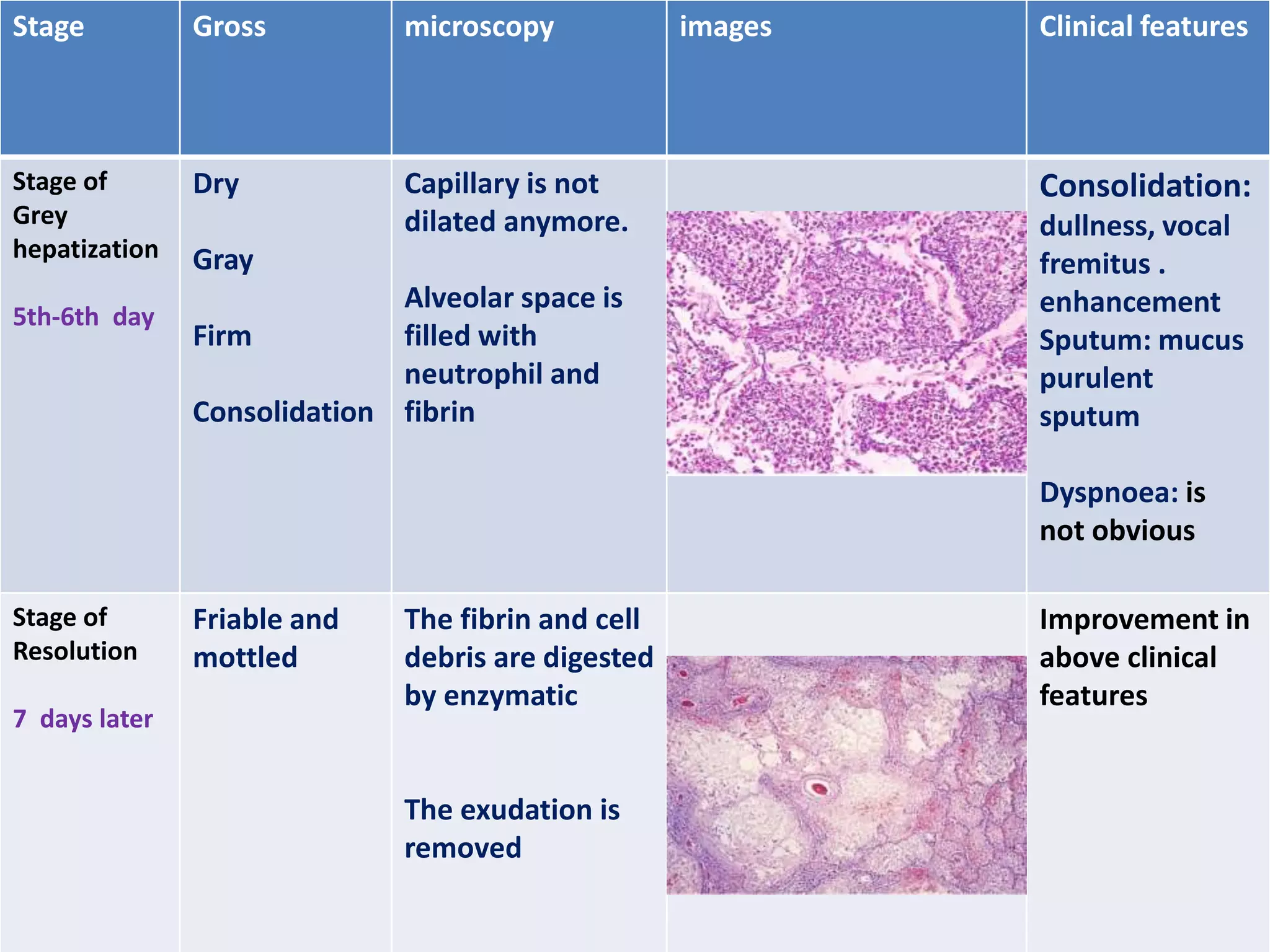 RESPIRATORY SYSTEM: PATHOLOGY OF PNEUMONIAS | PPTX