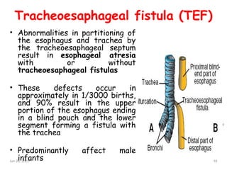 RESPIRATORY EMBRYOLOGY FOR MEDICAL STUDENTS | PPTX