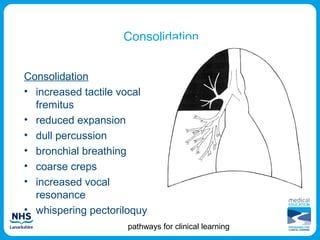 Respiratory Exam | PPT