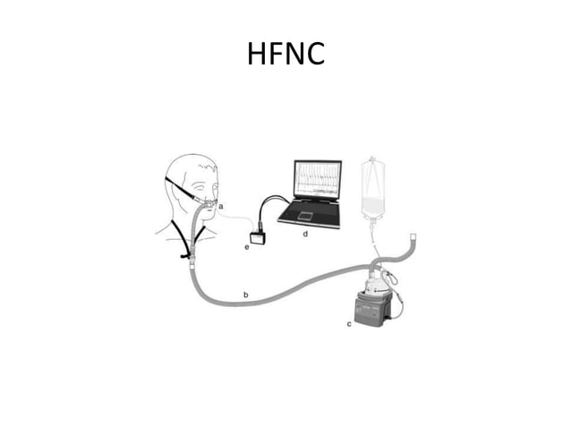 Resp failure talk 9 10 bipap and hfnc emphasis | PPT