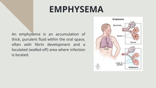 Respiratory and Cardiovascular Medical SurgeryPPT.pptx
