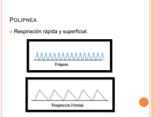 Respiracion | PPTX