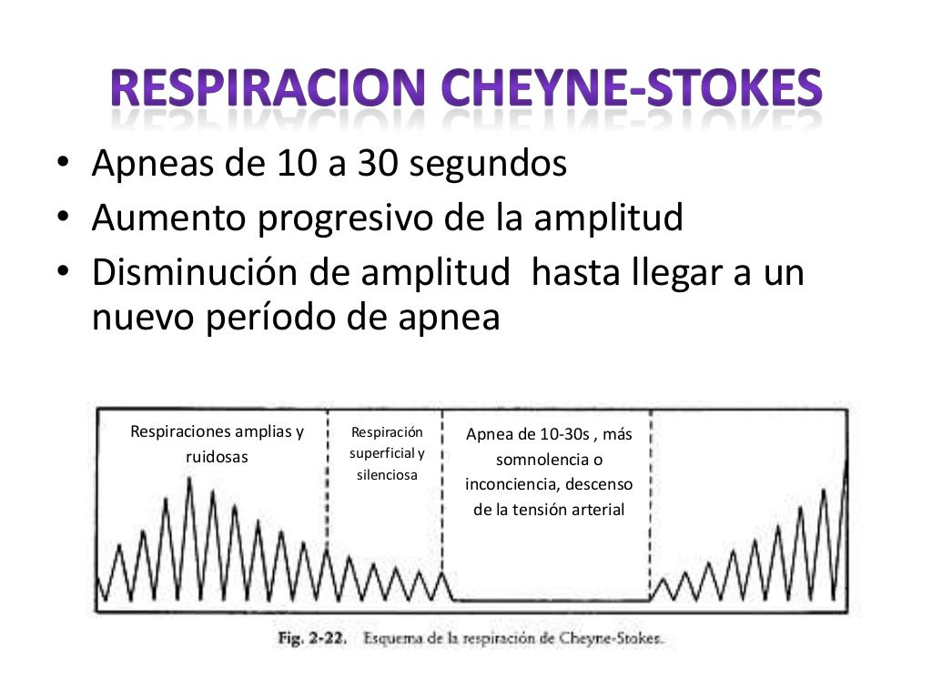 Ritmo De Cheyne Stokes - BRAINCP