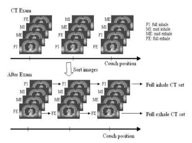 Respiration motion management | PPT | Lung and Respiratory Health ...