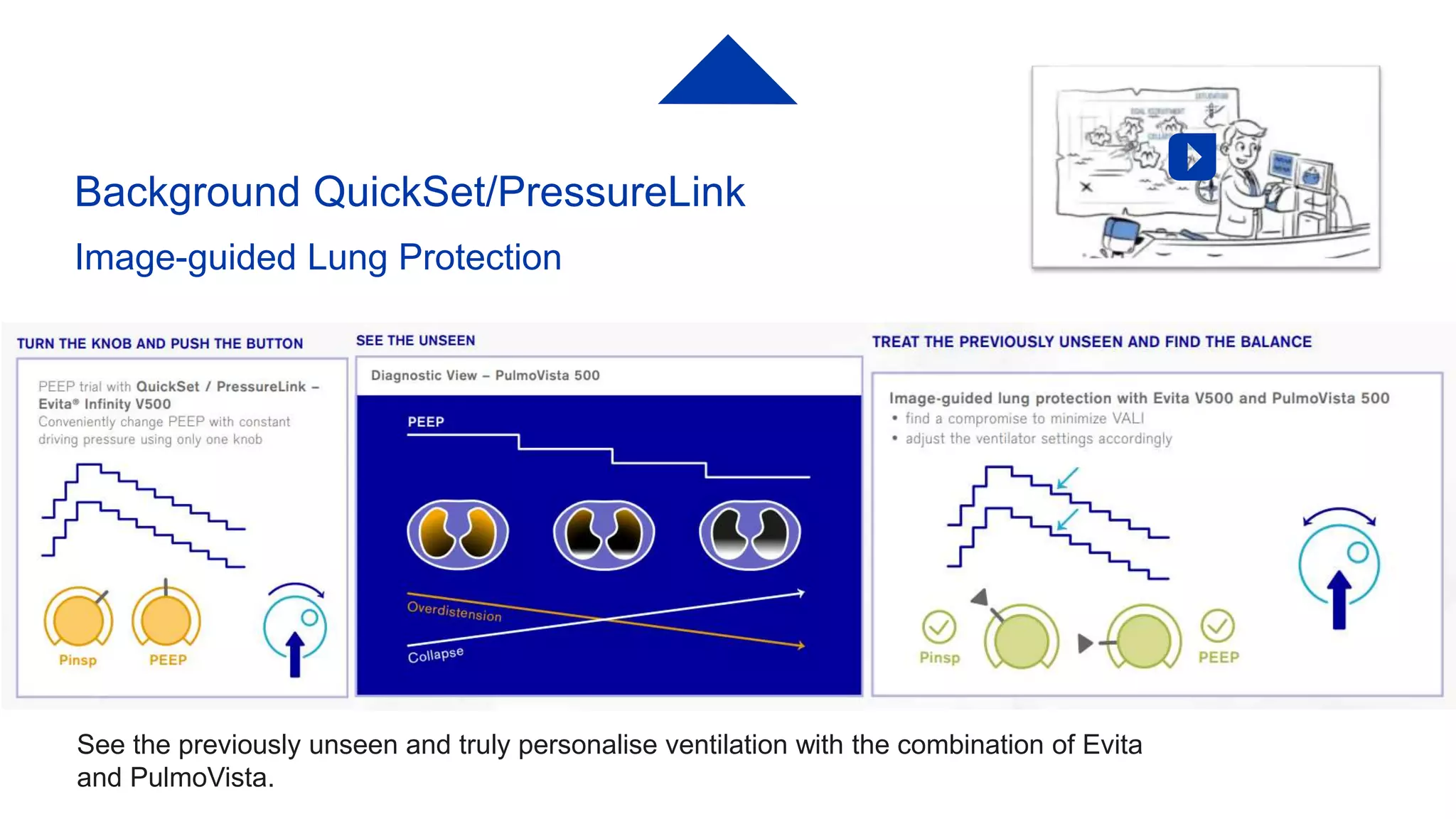 Respiration Pathway_Dräger Ventilation Story (1).pptx