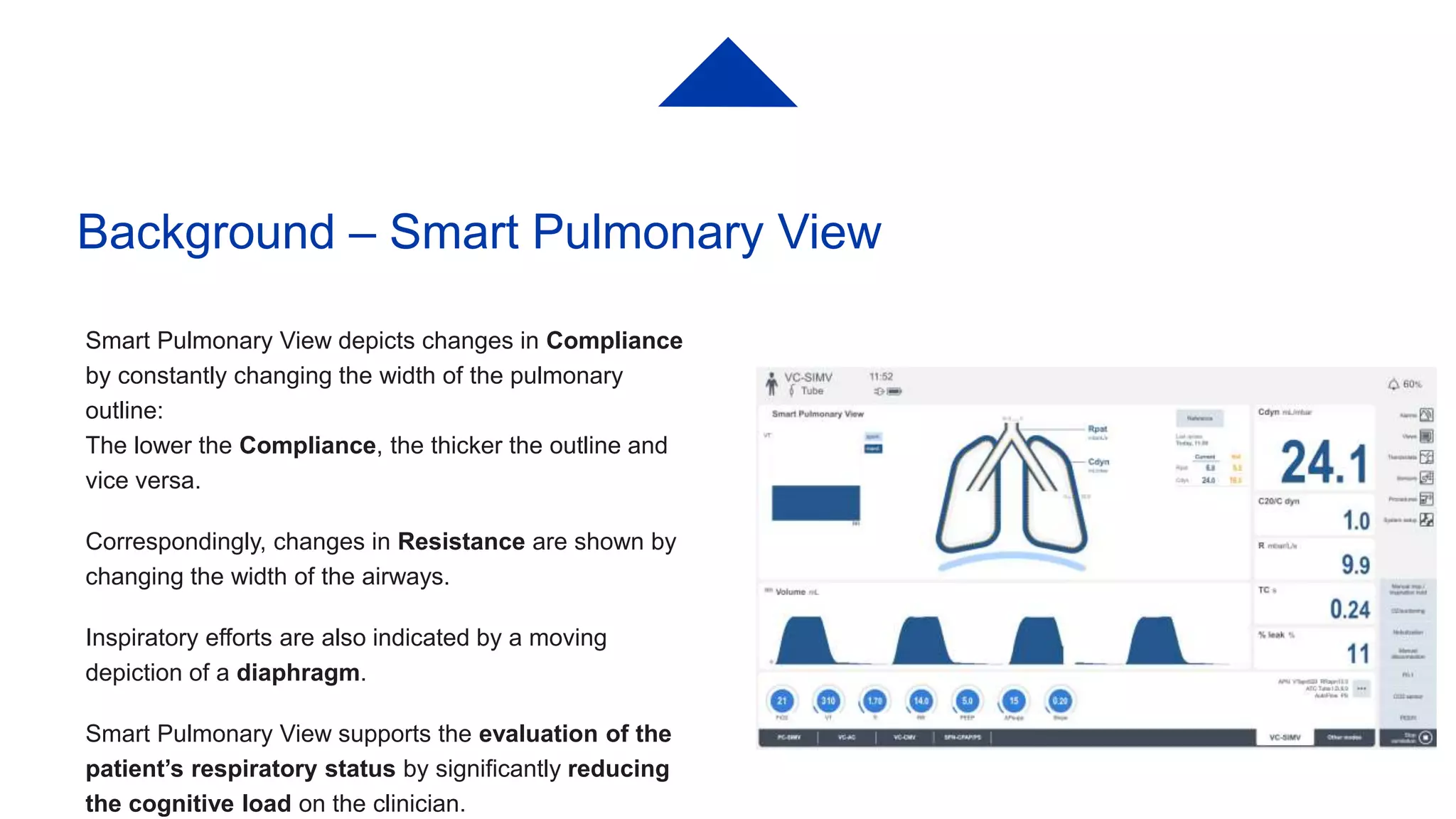 Respiration Pathway_Dräger Ventilation Story (1).pptx